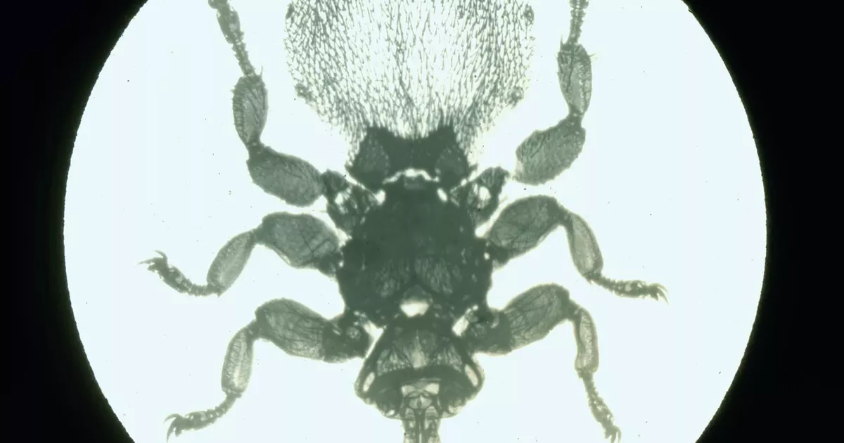 Microscopic view of six-legged bug - AGSA Collection