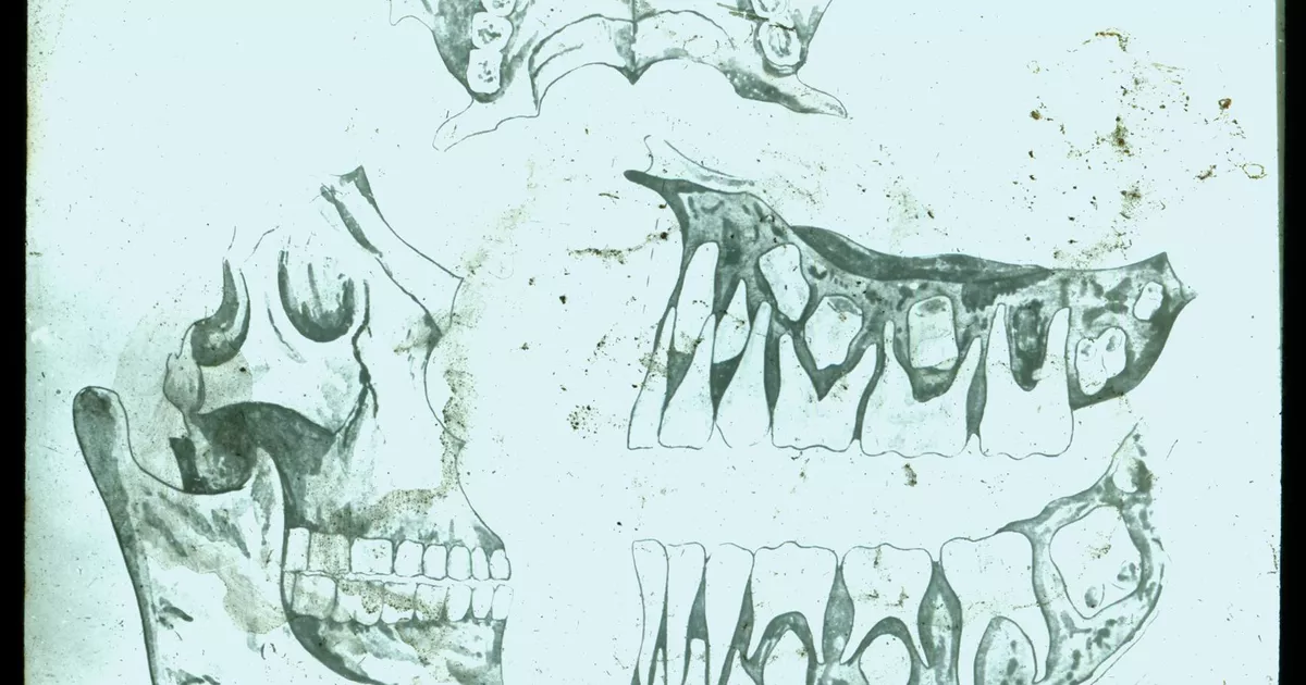Anatomical drawing: the jaw - AGSA Collection